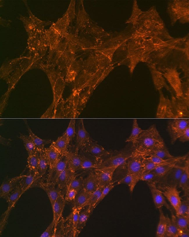 alpha Actinin 4 Recombinant Rabbit Monoclonal Antibody (ARC1959 ...