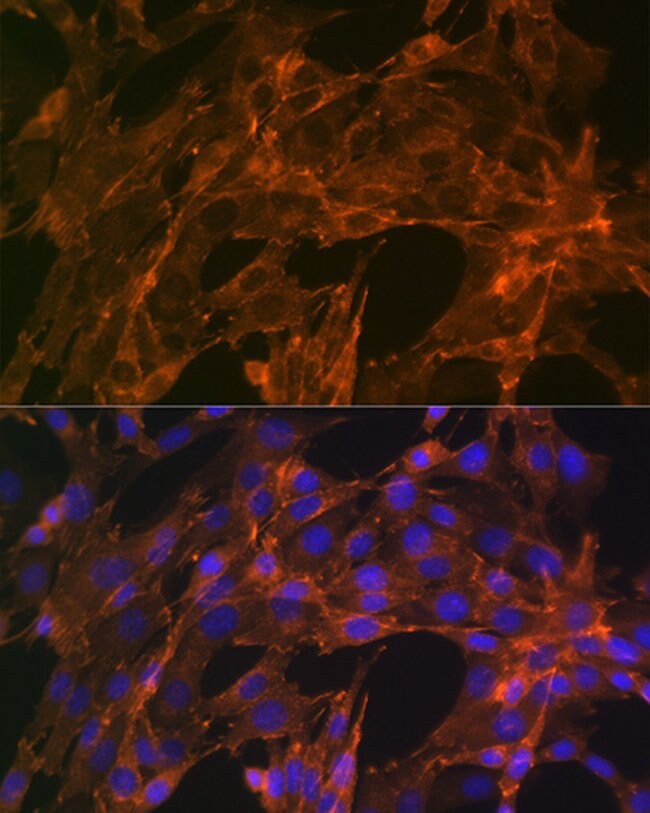 alpha Actinin 4 Recombinant Rabbit Monoclonal Antibody (ARC1959 ...
