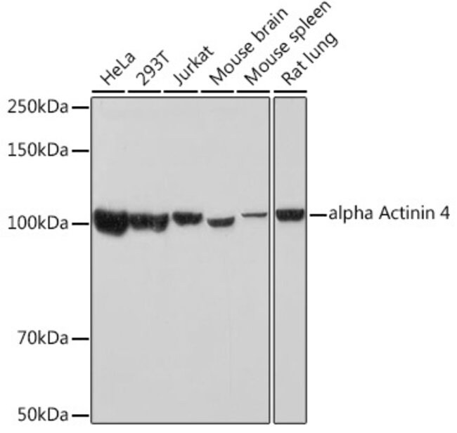 alpha Actinin 4 Recombinant Rabbit Monoclonal Antibody (ARC1959 ...