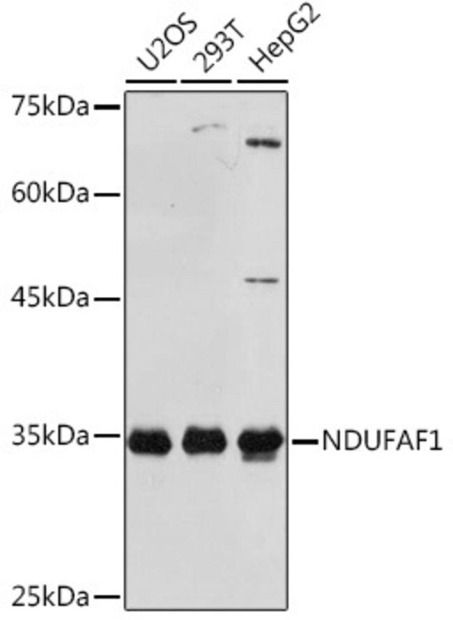 NDUFAF1 Recombinant Rabbit Monoclonal Antibody (ARC2091), Invitrogen ...