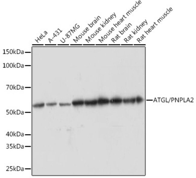 ATGL Recombinant Rabbit Monoclonal Antibody (ARC1192), Invitrogen 100 ...