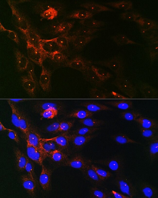 gamma Tubulin Rabbit anti-Human, Human, Mouse, Rat, Clone: ARC1684 ...