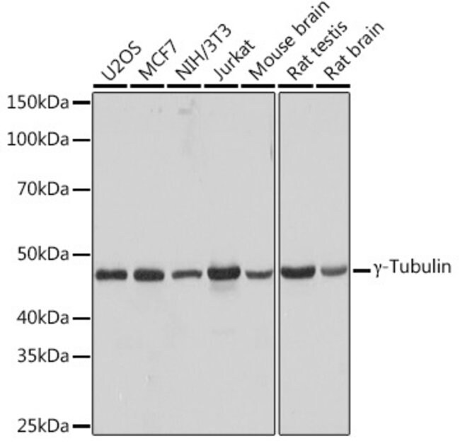 gamma Tubulin Recombinant Rabbit Monoclonal Antibody (ARC1684 ...