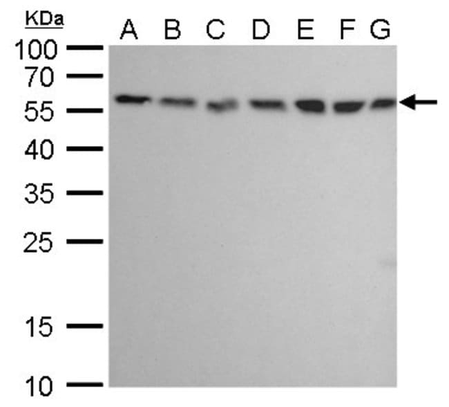 ATG12 Monoclonal Antibody (GT9411), Invitrogen 100 μL; Unconjugated ...