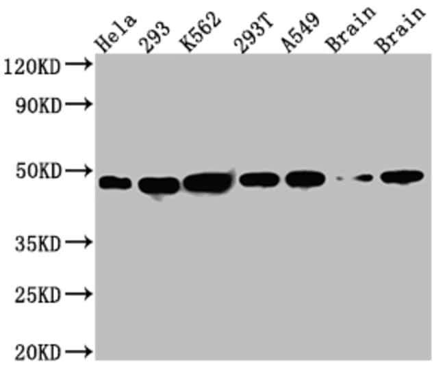 NUDC Recombinant Rabbit Monoclonal Antibody (6C3), Invitrogen™ 100 μL ...