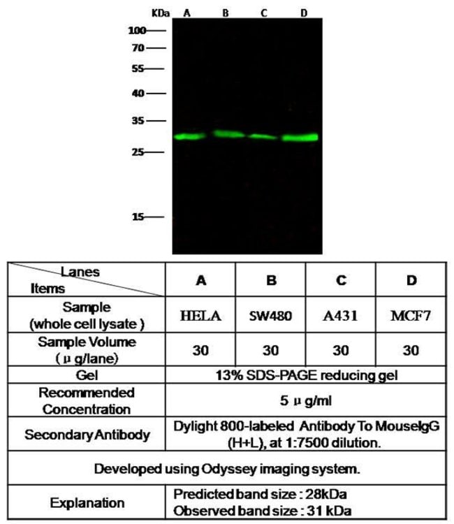 Invitrogen Galectin 3 Monoclonal Antibody (01) 100 μL; Unconjugated:Antikroppar | Fisher Scientific