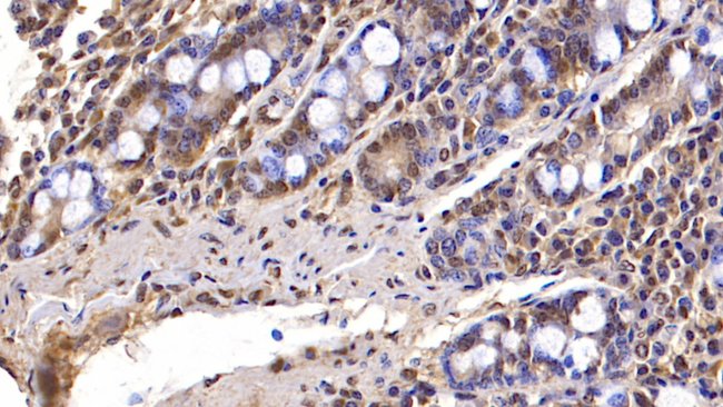 Fibulin 3 Monoclonal Antibody (C1), Invitrogen 20 μL; Unconjugated ...
