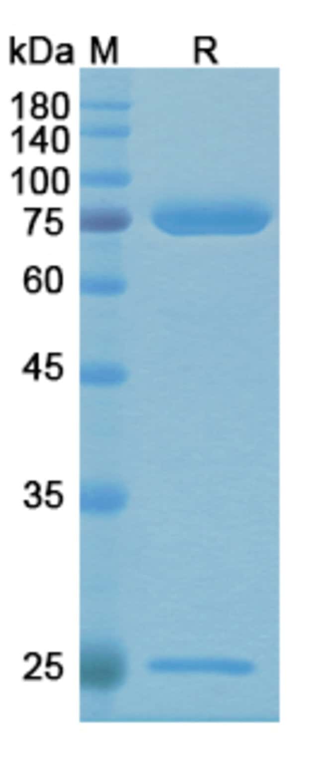 Alg-991 Recombinant Human Monoclonal Antibody, Invitrogen 100 μg ...