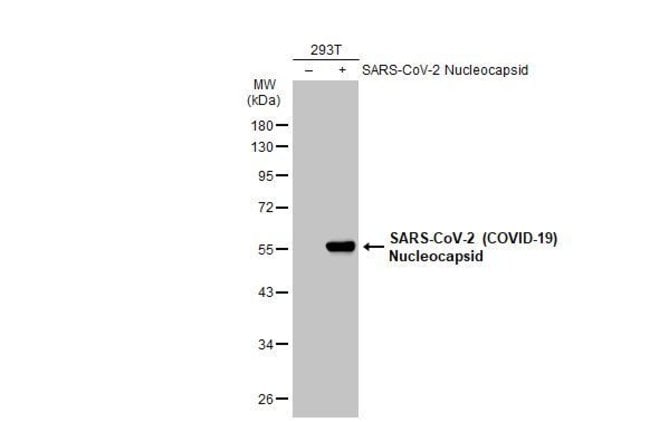 SARS/SARS-CoV-2 Nucleocapsid Mouse anti-Virus, Clone: GT113, Invitrogen ...