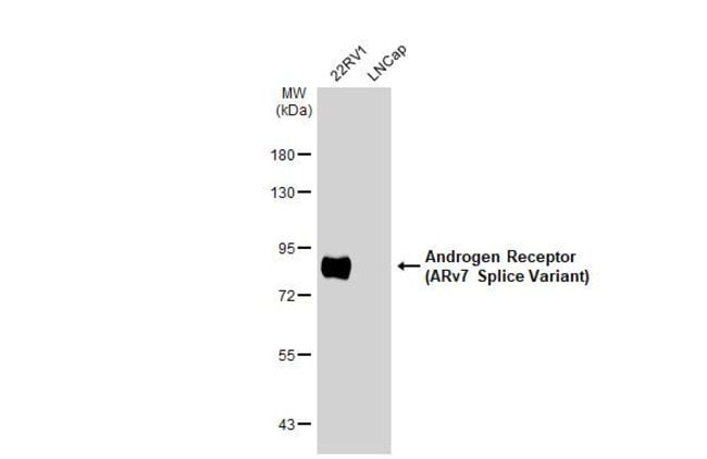 Androgen Receptor (ARv7 Splice Variant) Recombinant Rabbit Monoclonal ...
