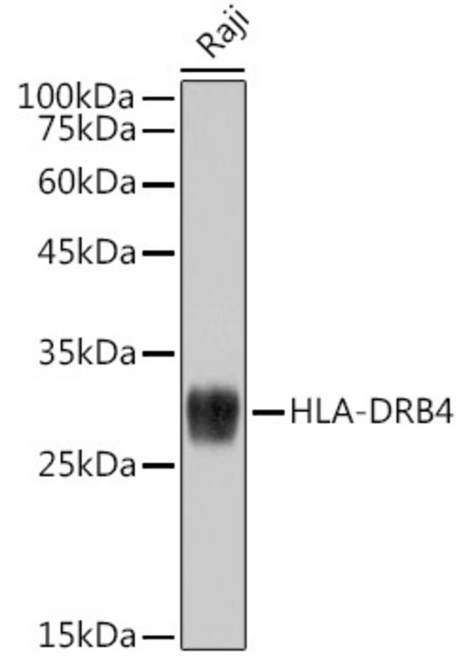 HLA-DRB4 Rabbit anti-Human, Clone: 3Z5V9, Invitrogen 100 μL; Unconjugated:Antibodies, | Fisher ...