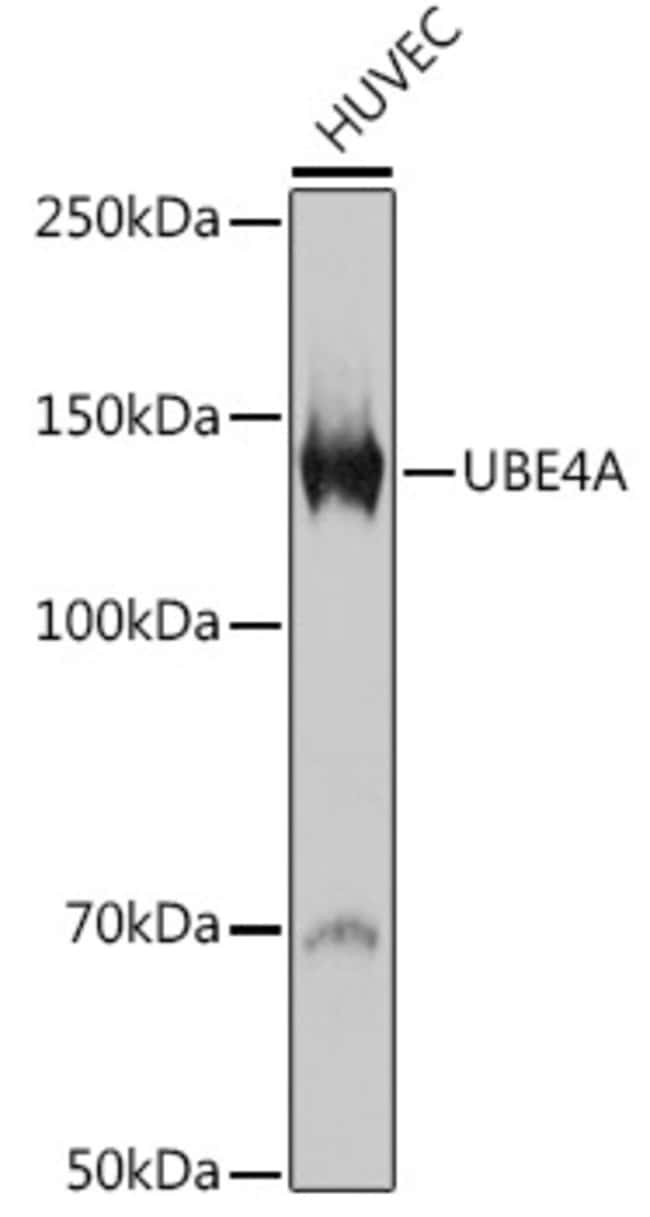 UBE4A Recombinant Rabbit Monoclonal Antibody (2A5N2), Invitrogen 100 μL; | Fisher Scientific