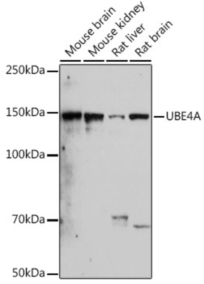 UBE4A Recombinant Rabbit Monoclonal Antibody (2A5N2), Invitrogen 100 μL; | Fisher Scientific