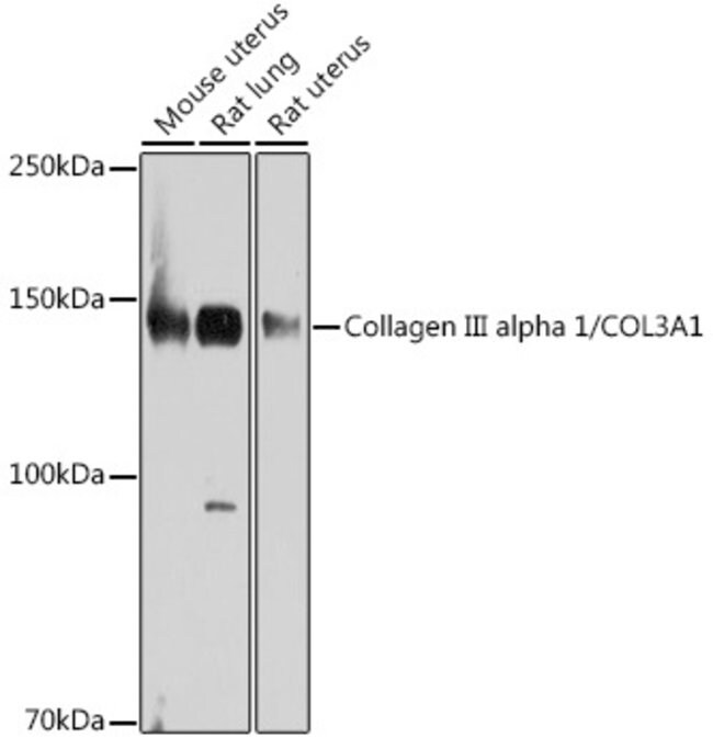 Collagen III Recombinant Rabbit Monoclonal Antibody (6Y9C6), Invitrogen ...
