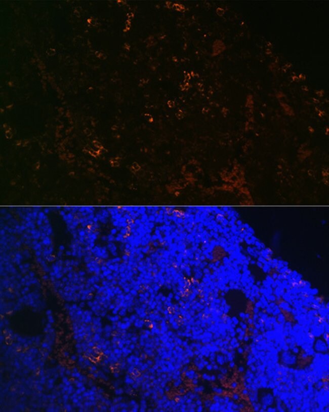 Myeloperoxidase Rabbit anti-Human, Mouse, Rat, Clone: 2A7C4, Invitrogen ...