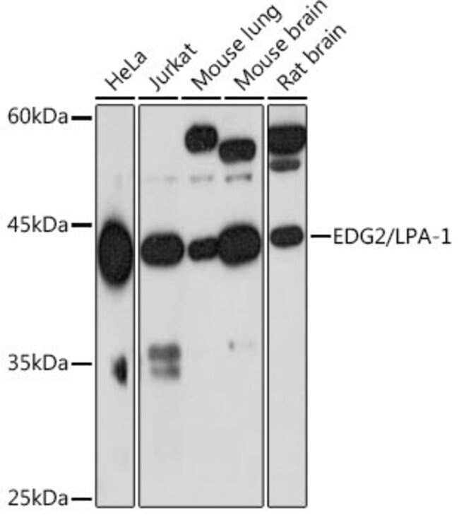 EDG2 Recombinant Rabbit Monoclonal Antibody (3U1Q0), Invitrogen 100 μL; | Fisher Scientific
