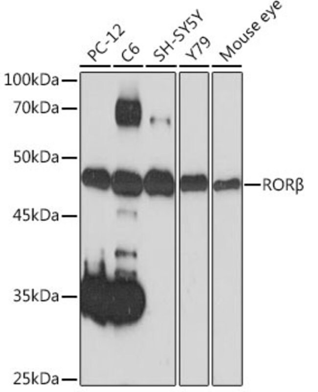 RORB Rabbit anti-Human, Mouse, Rat, Clone: 7J9T7, Invitrogen 100 μL ...
