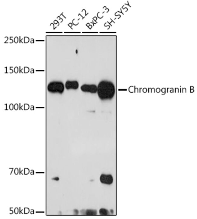 Chromogranin B Recombinant Rabbit Monoclonal Antibody (5N6T1 ...