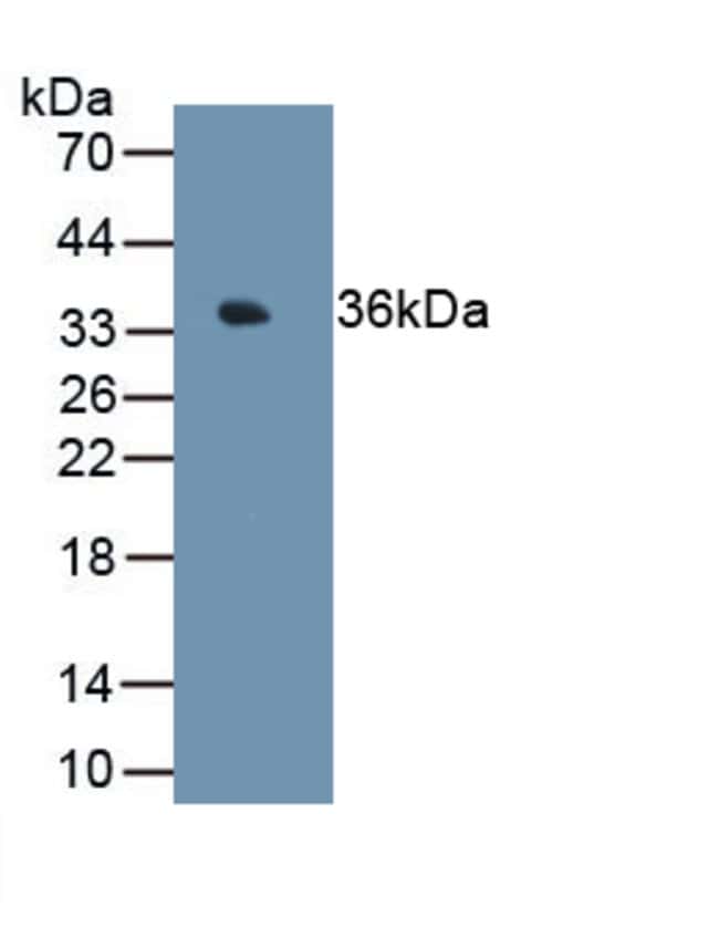 MT1E Monoclonal Antibody (C1), Invitrogen 20 μL; Unconjugated ...