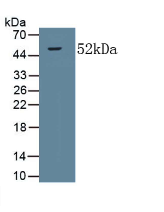 COL5A2 Monoclonal Antibody (C4), Invitrogen™ 100 μL; Unconjugated Ver ...