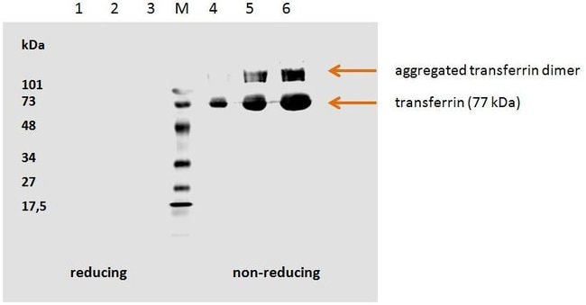Transferrin Monoclonal Antibody (HTF-14), Invitrogen 100 μg ...