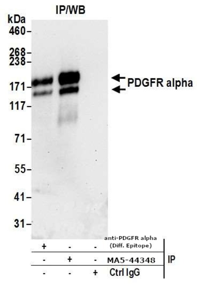 CD140a (PDGFRA) Recombinant Rabbit Monoclonal Antibody (BLR078G ...