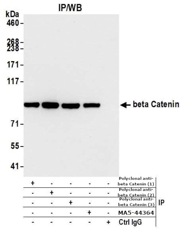 beta Catenin Recombinant Rabbit Monoclonal Antibody (BLR086G), Invitrogen | Fisher Scientific