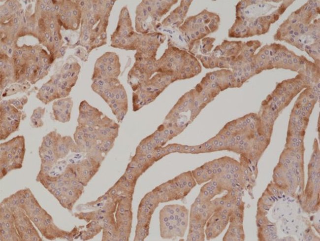 PSA Recombinant Rabbit Monoclonal Antibody (RM323), Biotin, Invitrogen ...