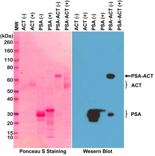 PSA Recombinant Rabbit Monoclonal Antibody (RM323), Biotin, Invitrogen ...