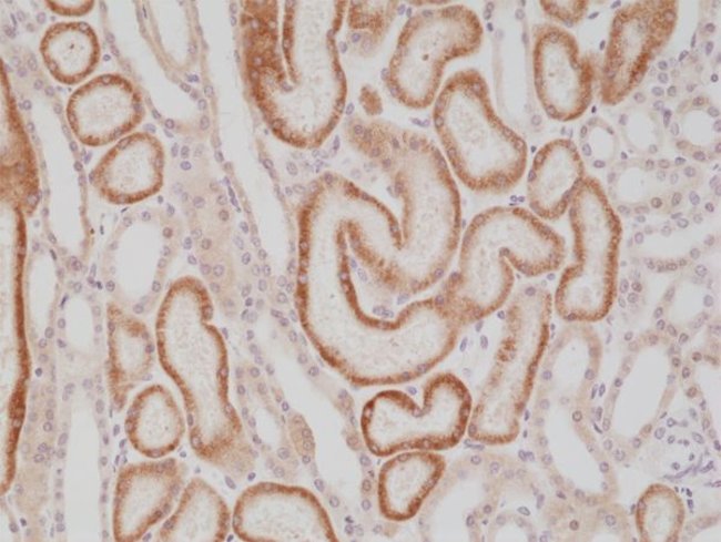 AMACR Recombinant Rabbit Monoclonal Antibody (RM349), Invitrogen 100 μL; | Fisher Scientific