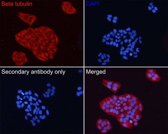 Invitrogen beta Tubulin Monoclonal Antibody (1-B11) 100 μL ...