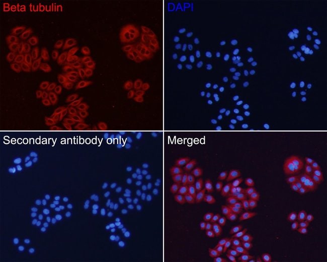 Invitrogen beta Tubulin Monoclonal Antibody (1-B11) 100 μL ...
