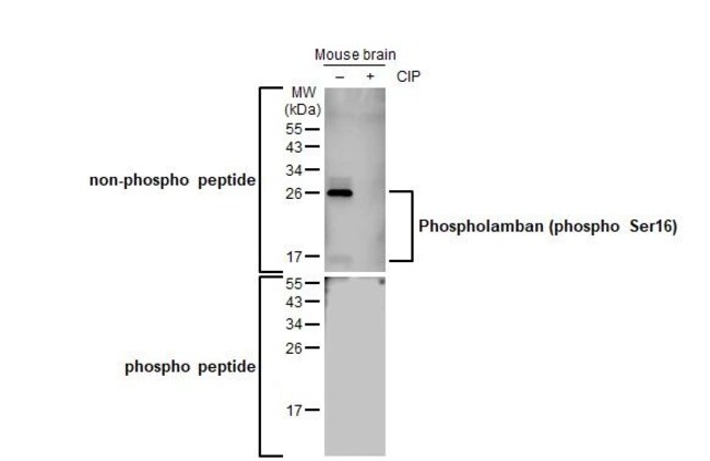Phospho-Phospholamban (Ser16) Monoclonal Antibody (HL1710), Invitrogen | Fisher Scientific