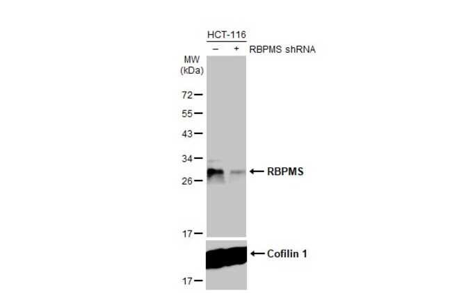 RBPMS Monoclonal Antibody (HL1106), Invitrogen 100 μL; Unconjugated ...