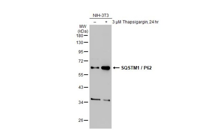 SQSTM1 Monoclonal Antibody (HL1113), Invitrogen 100 μL; Unconjugated ...