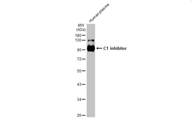 C1 inhibitor Recombinant Rabbit Monoclonal Antibody (HL1197 ...