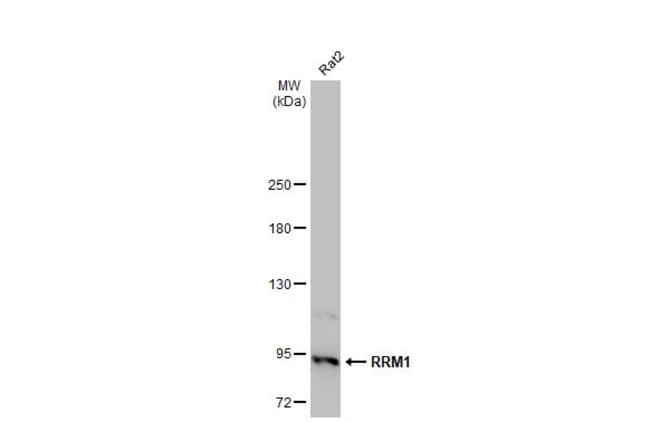 RRM1 Monoclonal Antibody (HL1230), Invitrogen 100 μL; Unconjugated ...