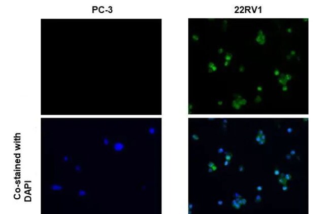 Androgen Receptor (ARv7 Splice Variant) Monoclonal Antibody (HL1240), Invitrogen | Fisher Scientific