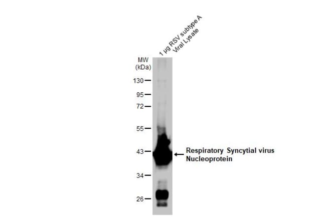 RSV NP Monoclonal Antibody (HL1247), Invitrogen 100 μL; Unconjugated ...