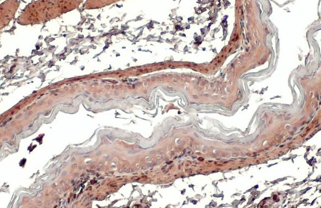 TAGLN Monoclonal Antibody (HL1270), Invitrogen 100 μL; Unconjugated ...