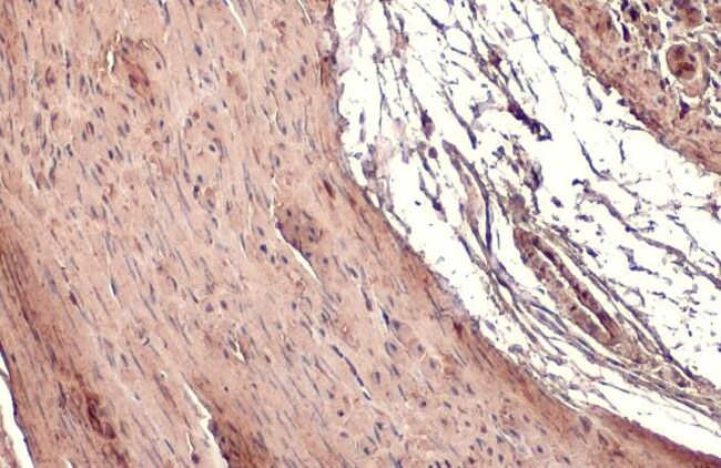 TAGLN Monoclonal Antibody (HL1270), Invitrogen 100 μL; Unconjugated ...