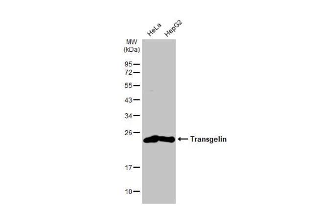 TAGLN Monoclonal Antibody (HL1270), Invitrogen 100 μL; Unconjugated ...