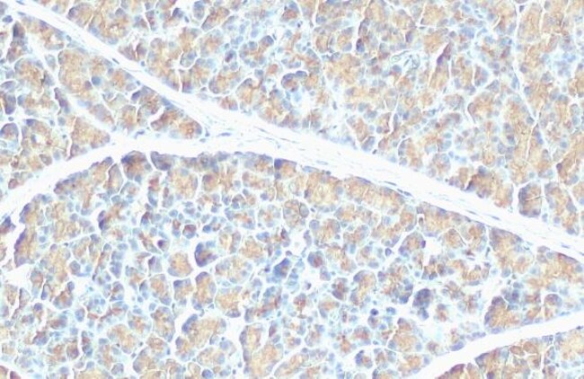 PNLIP Recombinant Rabbit Monoclonal Antibody (HL1310), Invitrogen 100 ...