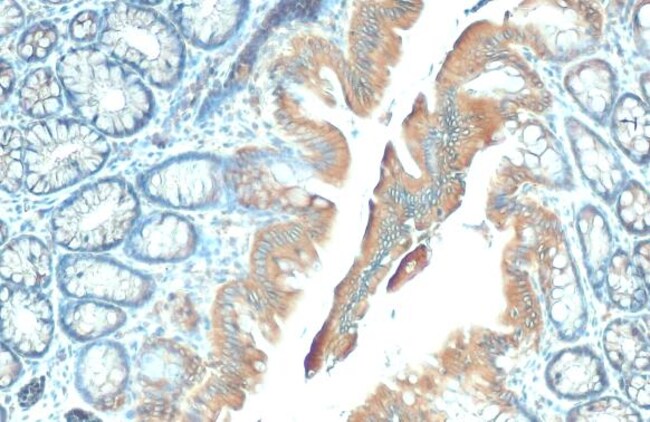 GSPT1 Monoclonal Antibody (HL1346), Invitrogen 100 μL; Unconjugated ...