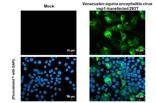 Venezuelan Equine Encephalitis Virus NSP1 Monoclonal Antibody (HL1472 ...