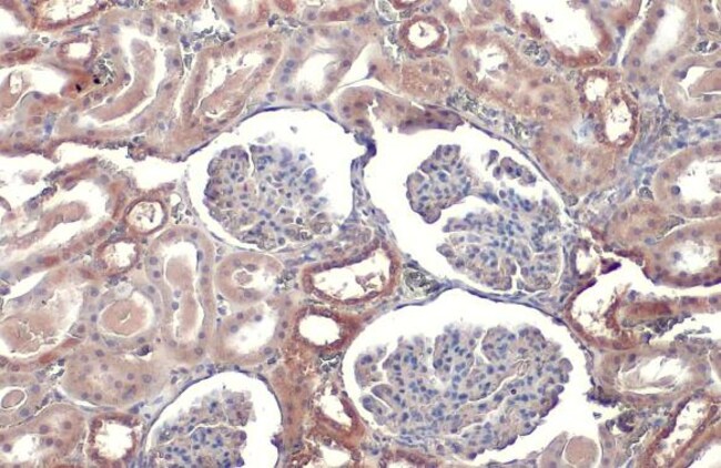 TOMM20 Monoclonal Antibody (HL1493), Invitrogen 100 μL; Unconjugated ...