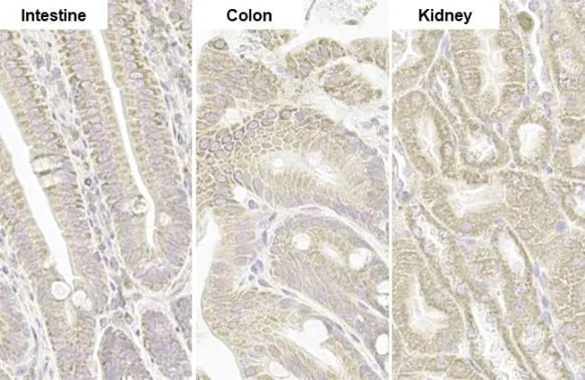 TOMM20 Monoclonal Antibody (HL1493), Invitrogen 100 μL; Unconjugated ...