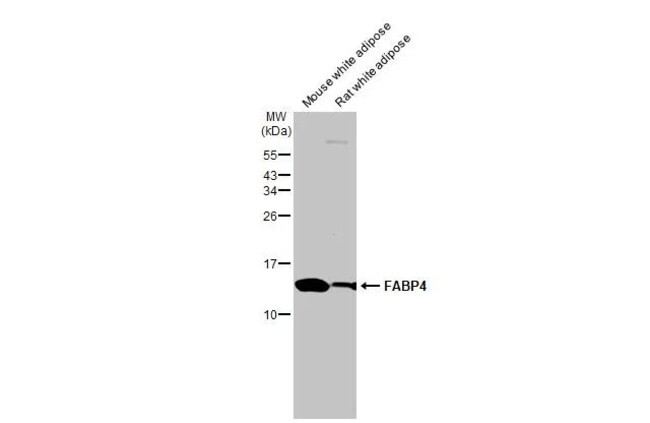 FABP4 Monoclonal Antibody (HL1520), Invitrogen 100 μL; Unconjugated ...