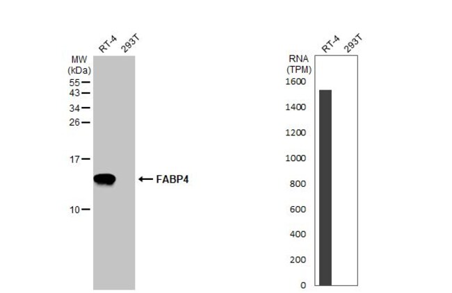 FABP4 Monoclonal Antibody (HL1520), Invitrogen 100 μL; Unconjugated ...