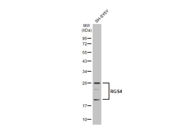 RGS4 Monoclonal Antibody (HL1522), Invitrogen 100 μL; Unconjugated ...